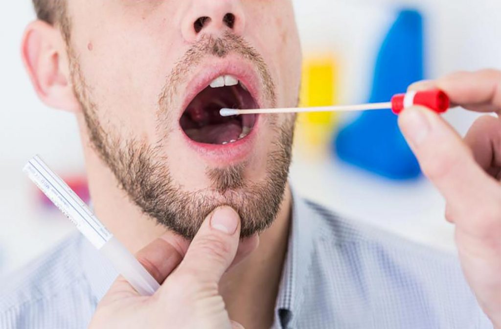 ANGINE : Les tests pratiqués en pharmacie remboursés en 2020 - RMP